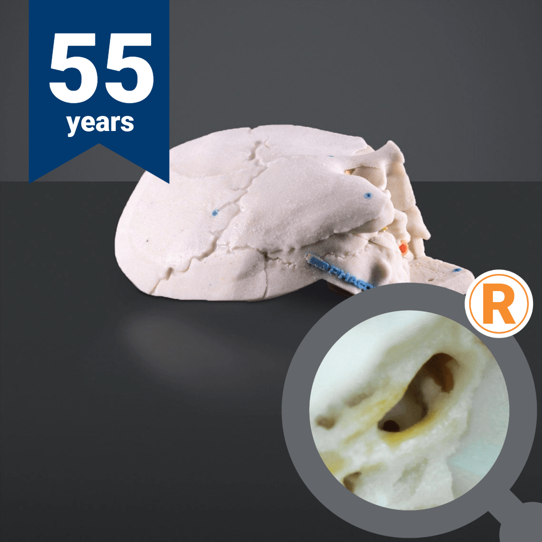 [TF-bae] PHACON Temporal Bone Patient "Schmidt" - round window membrane