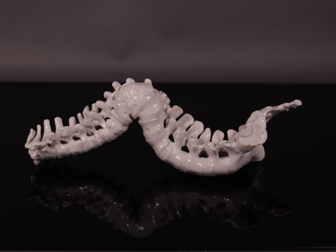 [SP-ga] PHACON Spine Patient "Kramer"